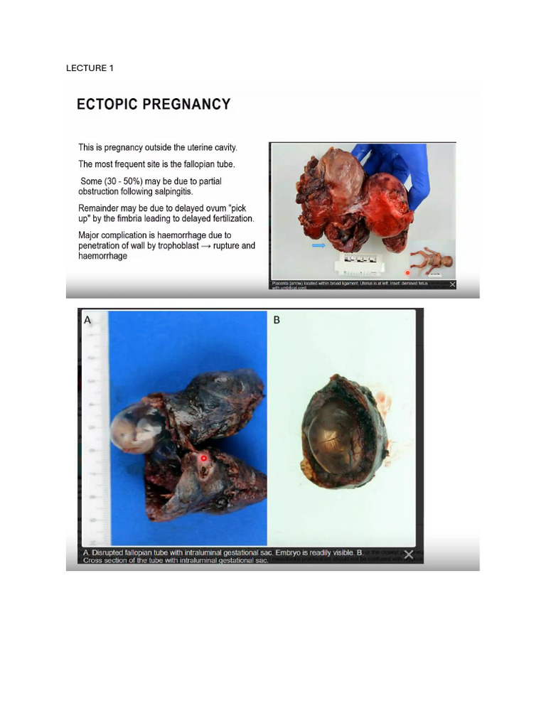 Anatomical Pathology Block 4 Practicals | PDF