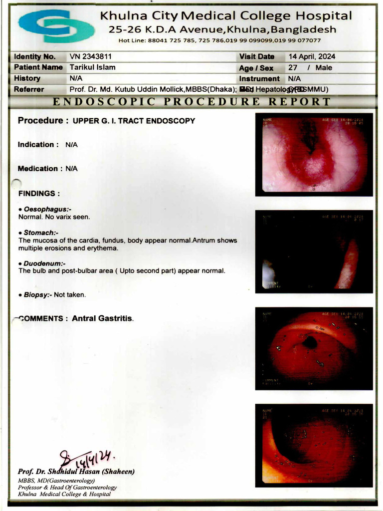 Upper GI Endoscopy Report: Antral Gastritis | PDF