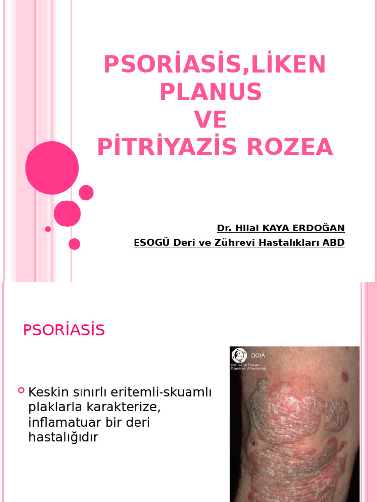 Pitriazis Rozea, Liken Planus | PDF