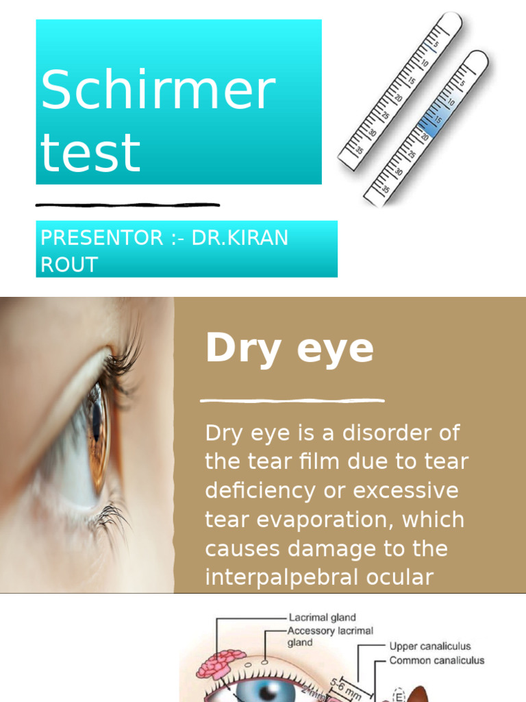Schirmer Test for Dry Eye Diagnosis | PDF | Ophthalmology | Human ...