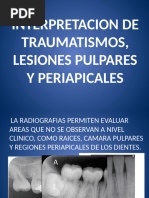 Características Radiográficas de Las Lesiones Periapicales 2020 | PDF ...