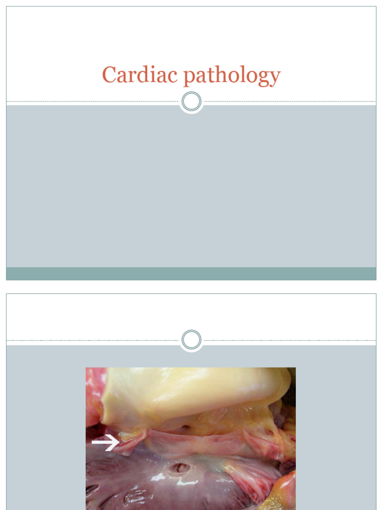 Common Cardiac Pathologies Overview | PDF