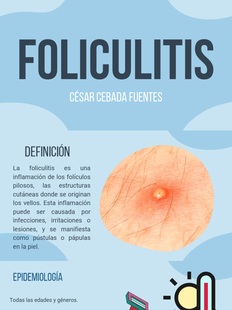 Guía sobre Foliculitis y su Tratamiento | PDF | Enfermedades y ...