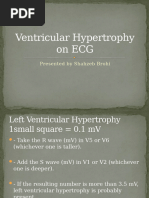 Ecg Interpretation J Point Stemi Criteria Equivalents and Others | PDF ...