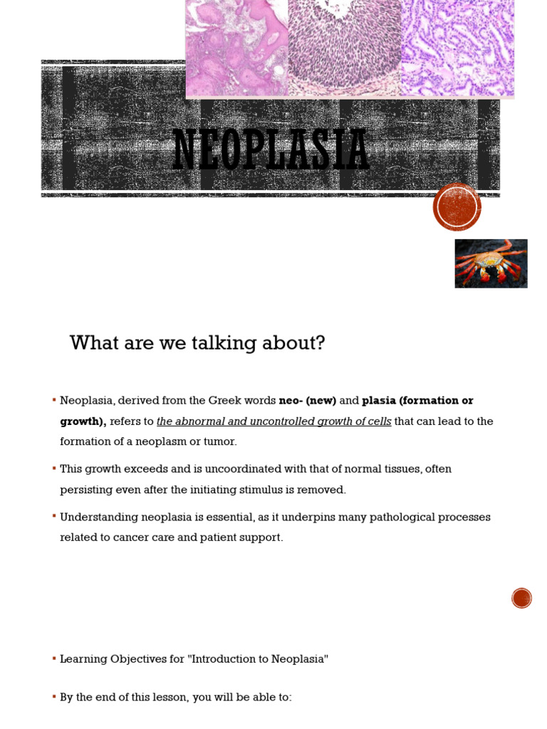 Understanding Neoplasia and Tumors | PDF | Neoplasms | Epithelium