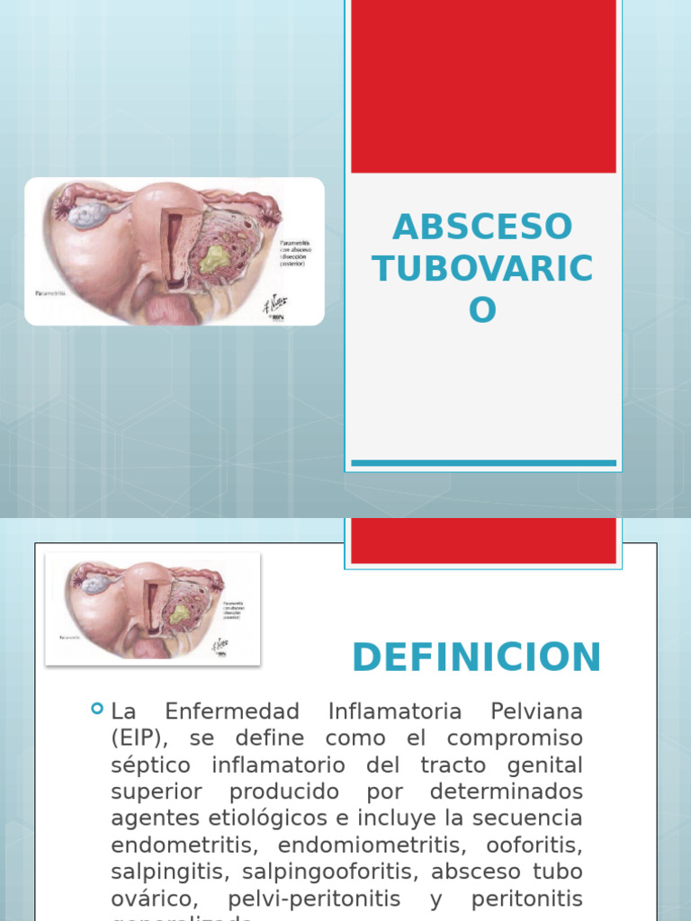 Absceso Tuboovárico: Definición y Tratamiento | PDF | Especialidades ...