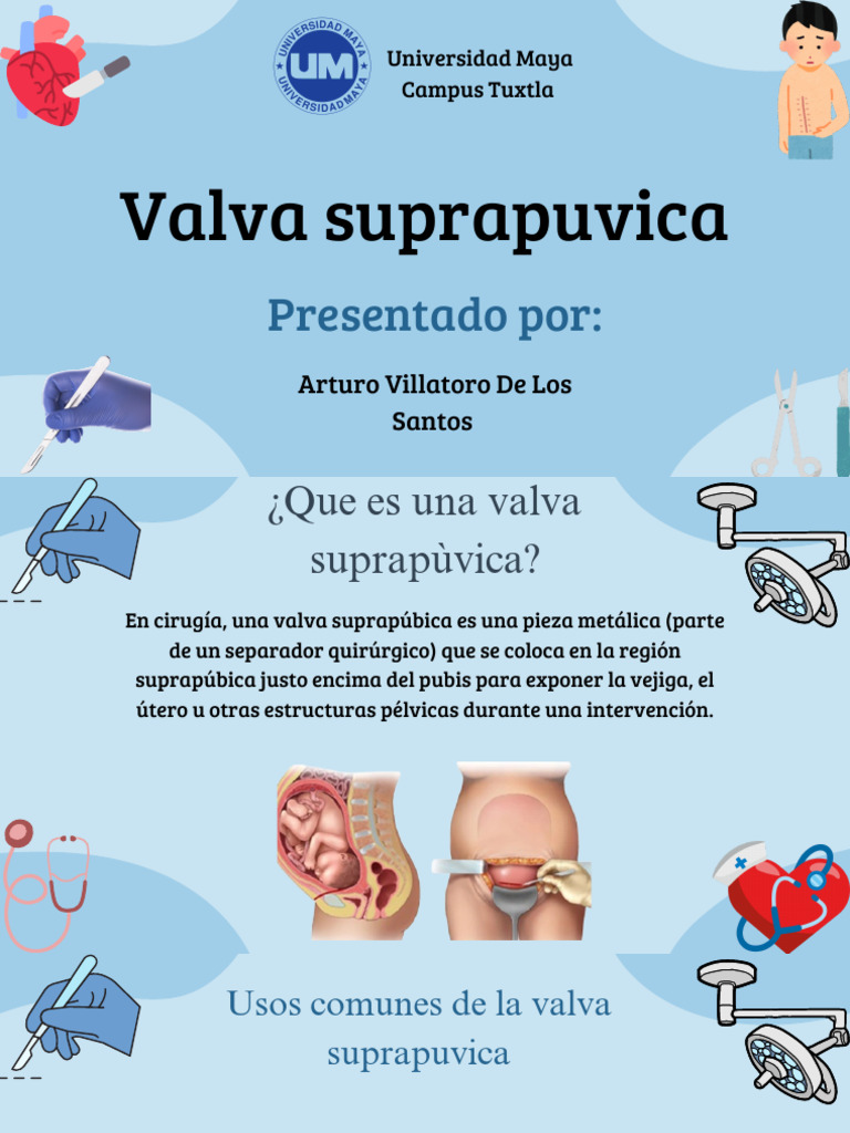 Valva Suprapuvica - Villatoro de Los Santos Arturo de Jesus | PDF