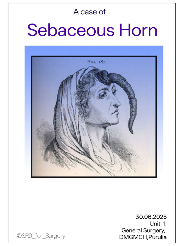 Sebaceous Horn | PDF