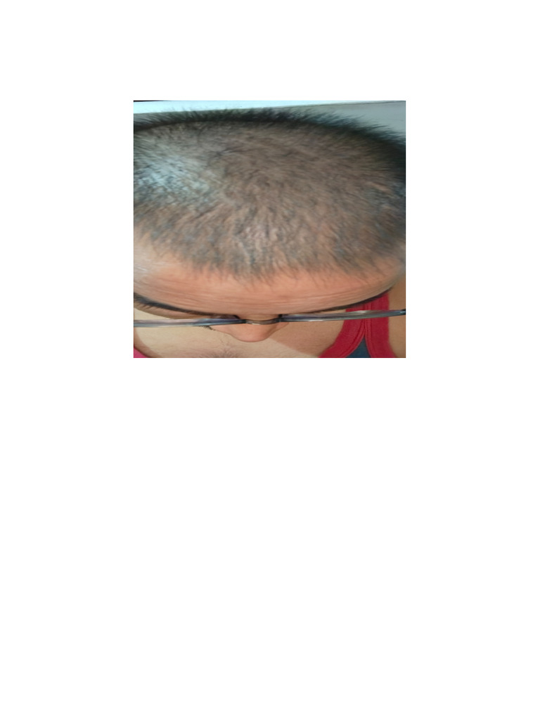 Hair Growth Tracker With Photo | PDF