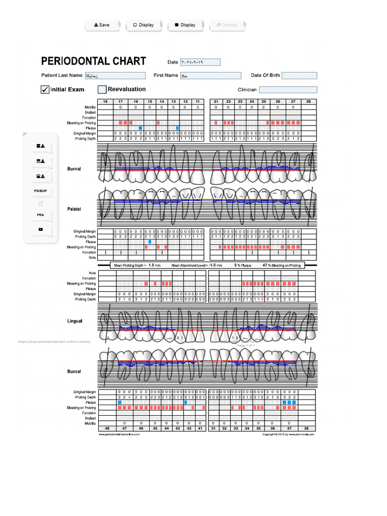 Periodontal Chart Online | PDF