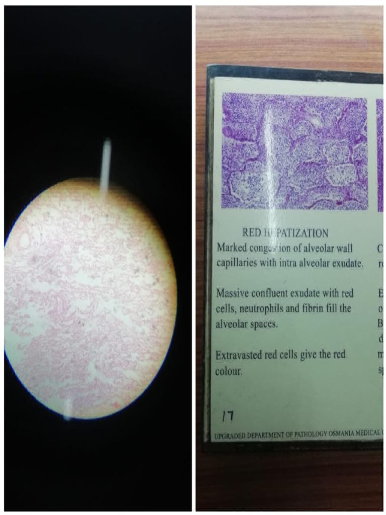 Histopathology Slides 2 | PDF