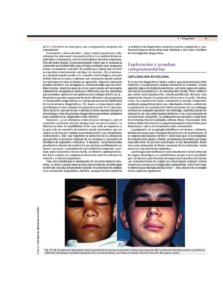 Exploración y Pruebas Complementarias Pera Determinar Vitalidad Pulpar ...