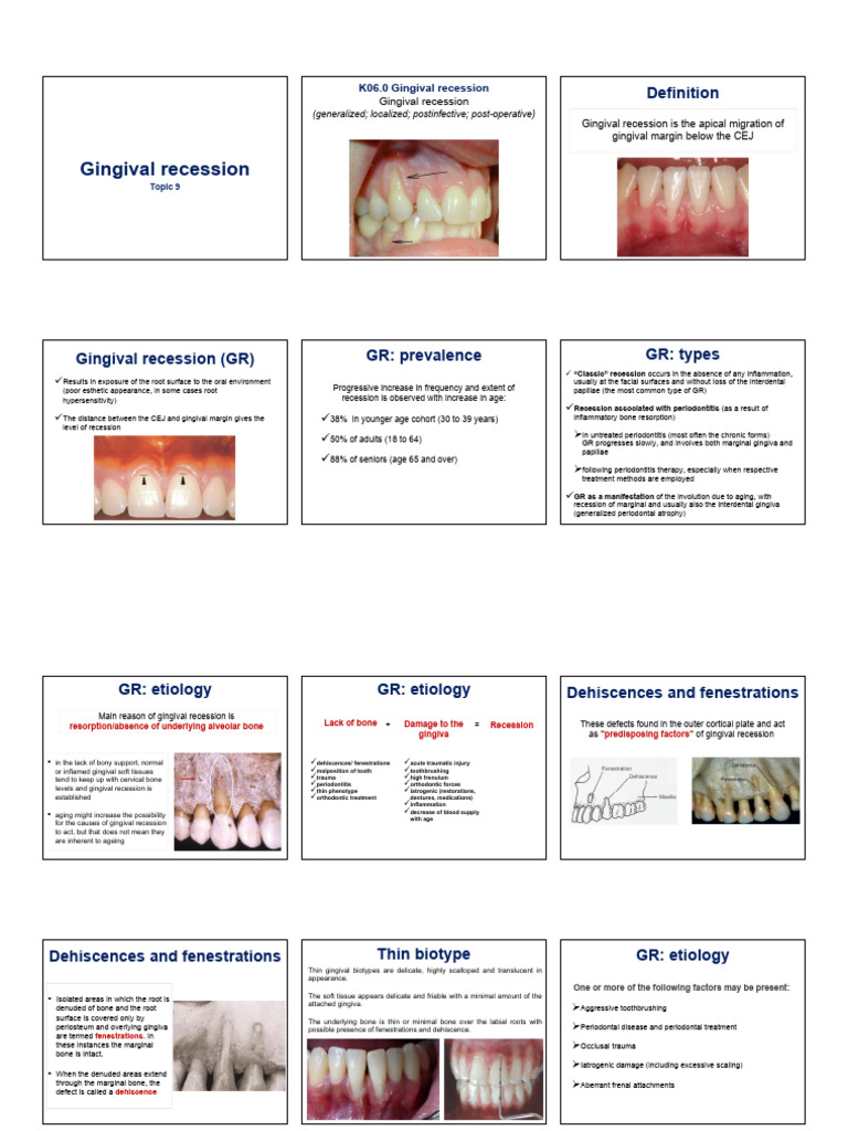 Understanding Gingival Recession Causes | PDF | Periodontology | Mouth