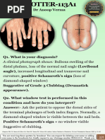 Understanding Clubbing and Its Grades | PDF