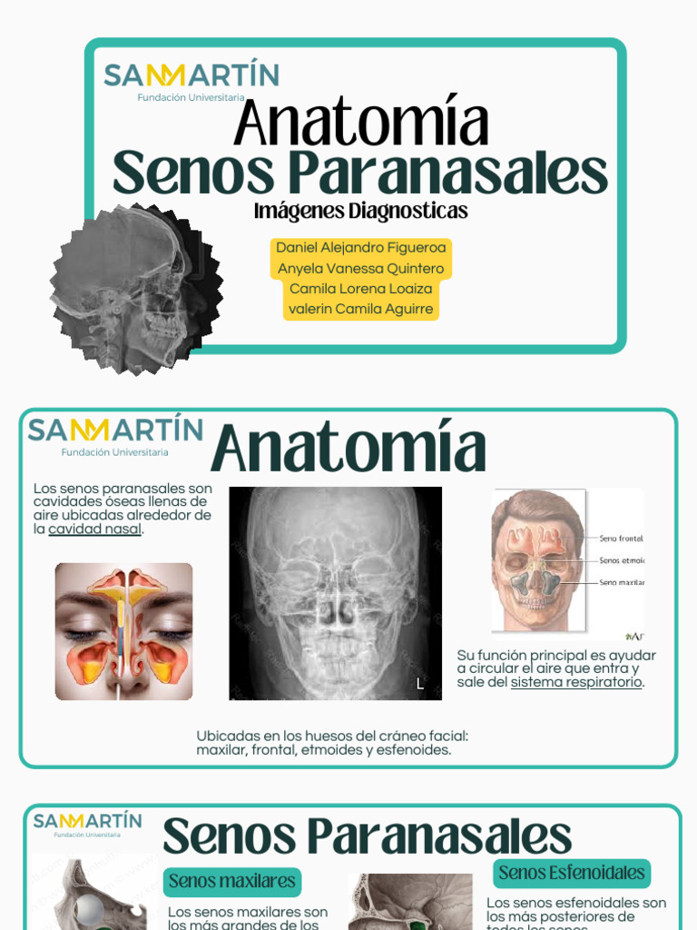 Anatomía y Patologías de Senos Paranasales | PDF | Cabeza y cuello ...