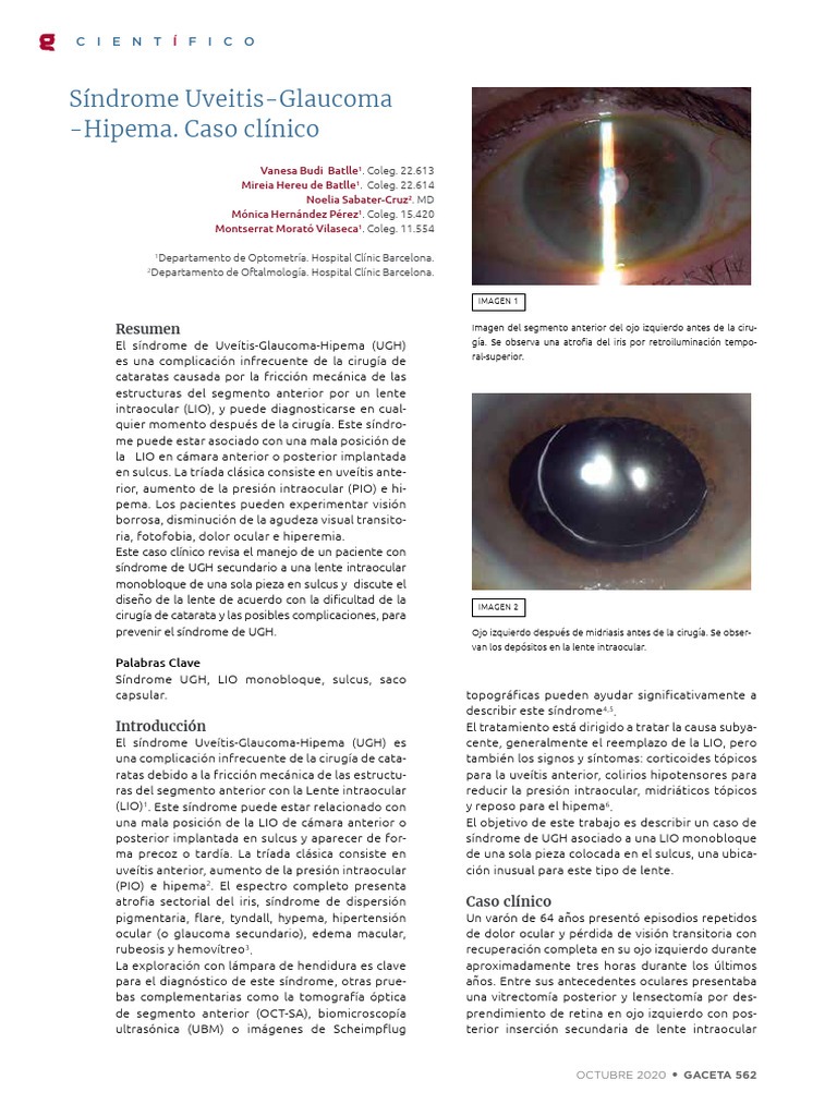 Síndrome Uveitis-Glaucoma-Hipema. | PDF | Enfermedades y trastornos ...