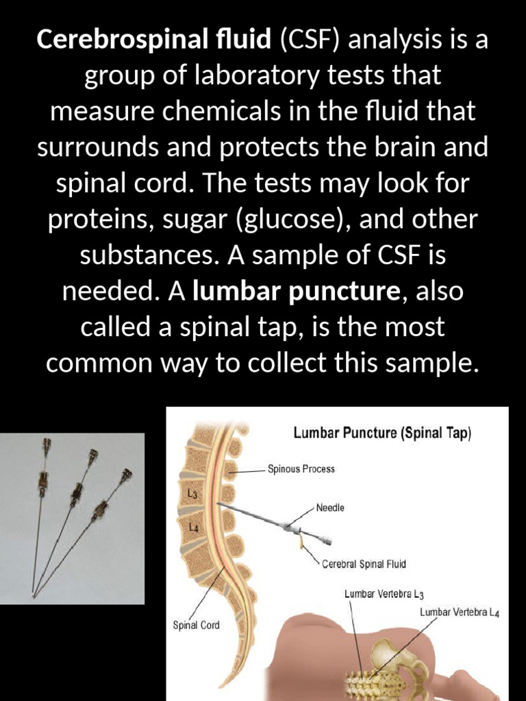 CSF Analysis 044840 | PDF