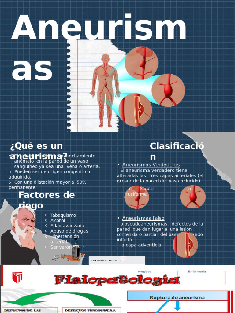 Aneurismas | PDF | Aorta | Medicina CLINICA