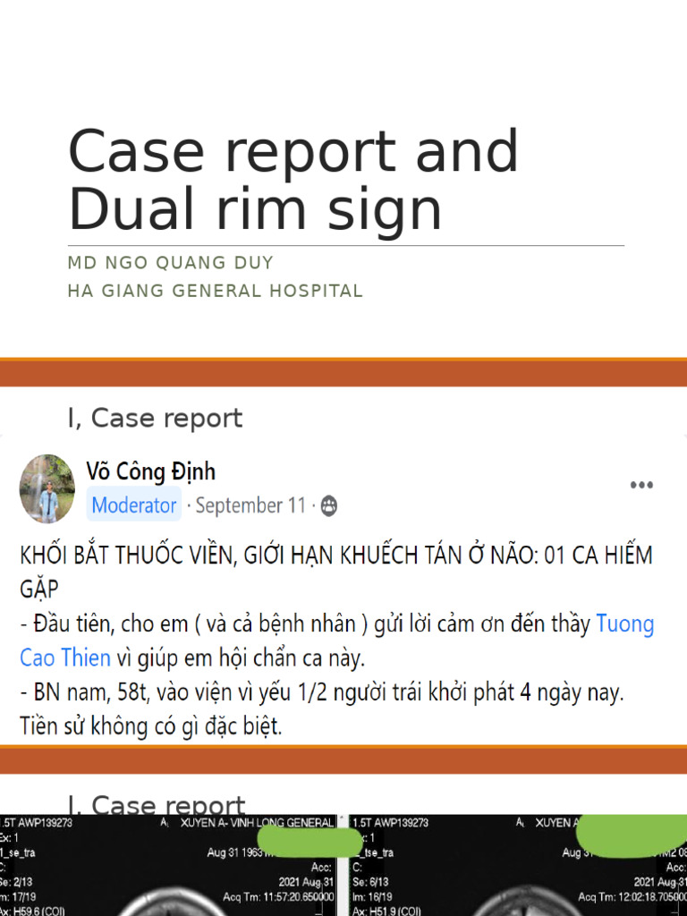 Case Report and Dual Rim Sign | PDF