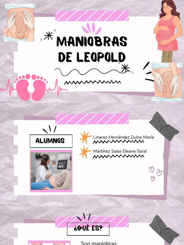 Maniobras de Leopold | PDF | Salud maternal | Obstetricia