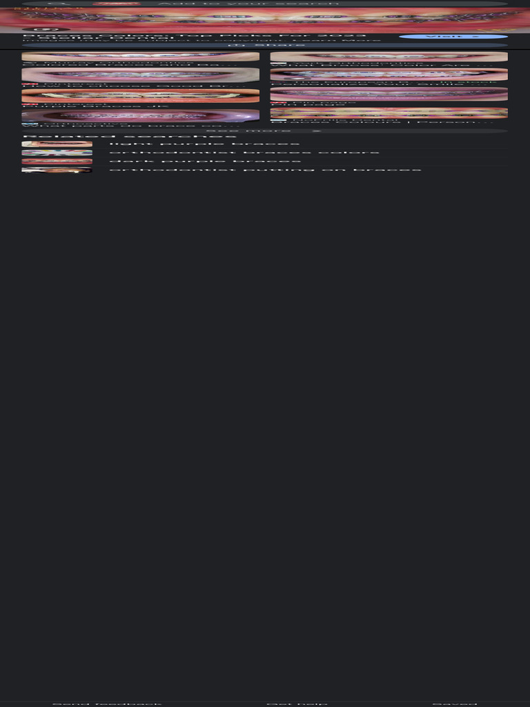 Purple Braces Color Guide 2023 | PDF