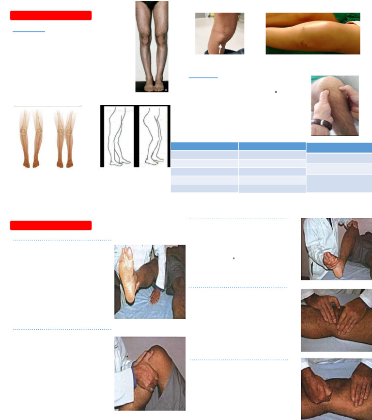 Maniobras de Exploración de La Rodilla | PDF | Rodilla | Mano