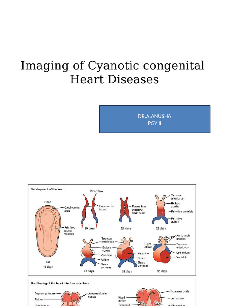 DR a.anusHAImaging of Cyanotic CHD- . (3) | PDF | Congenital Heart ...