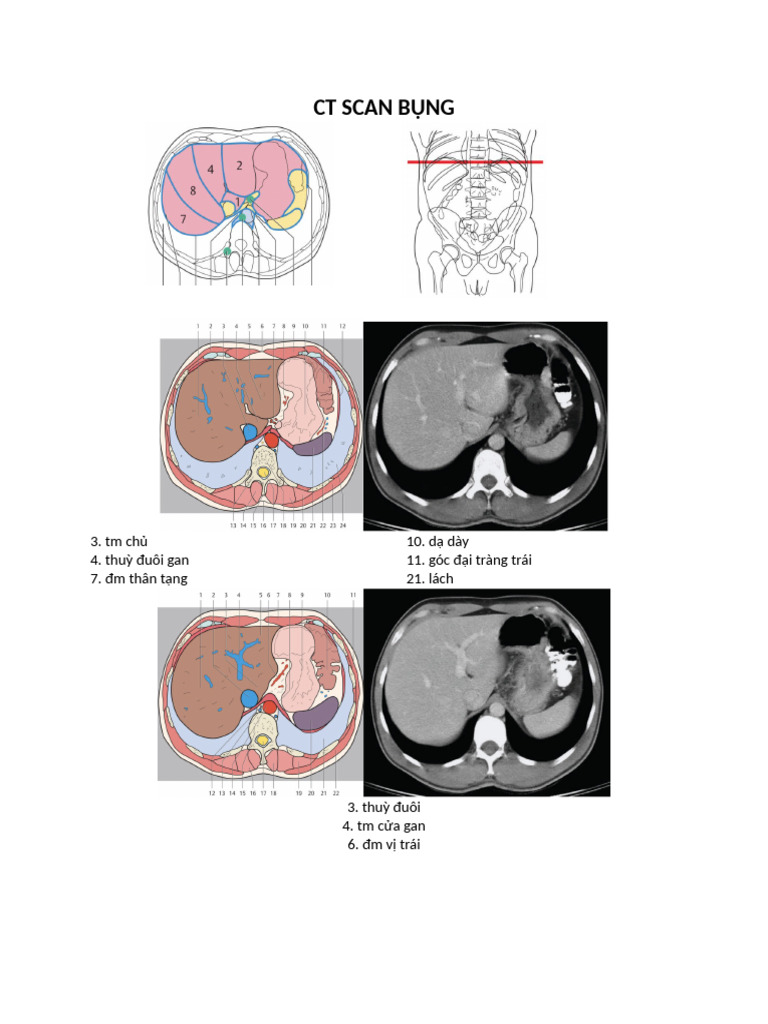 CT Scan B NG | PDF