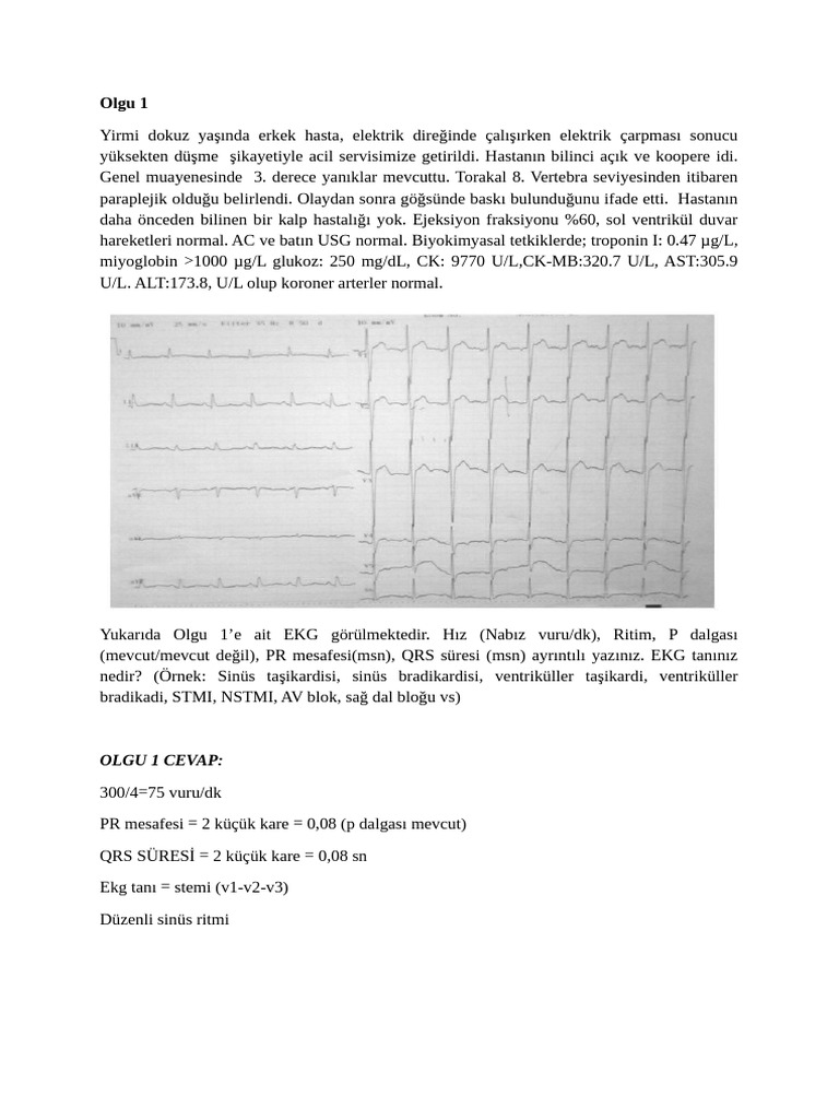 Ekg Olgu Sunumları | PDF