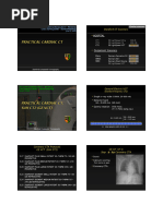 Revised Cardiac Risk Index - UpToDate | PDF | Myocardial Infarction ...