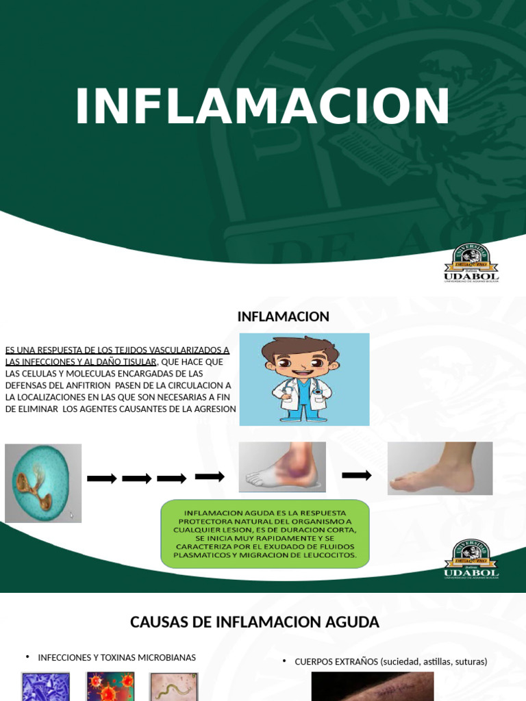 Causas y Características de la Inflamación | PDF | Inflamación | Macrófago