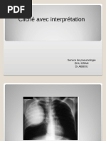 Sémiologie radiologique du syndrome bronchique | PDF | Poumon ...