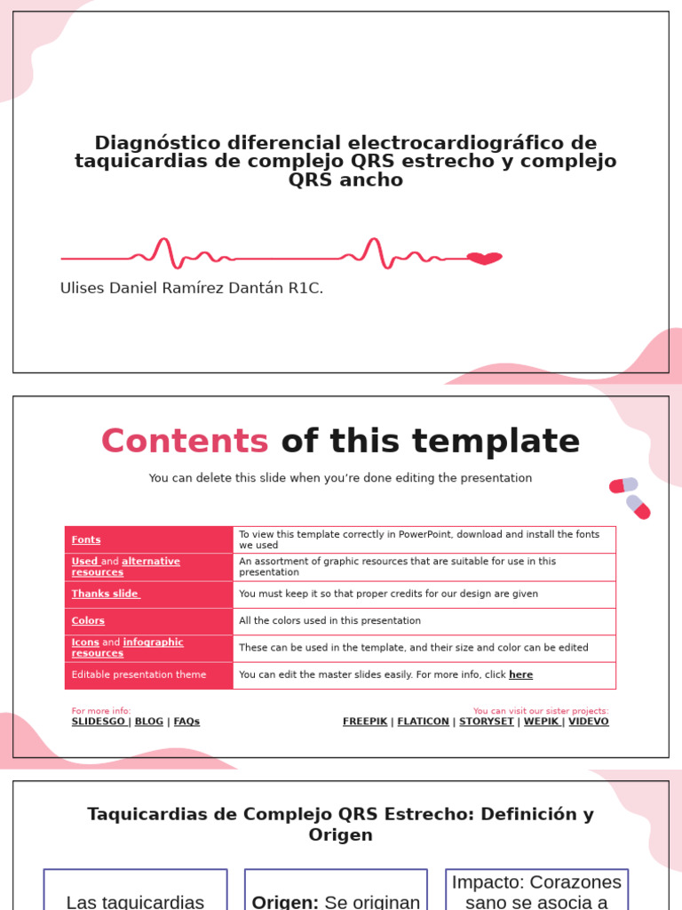 Diagnóstico Diferencial Electrocardiográfico de Taquicardias de ...