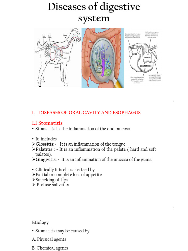 25 Diseases of Digestive System | PDF | Esophagus | Legume