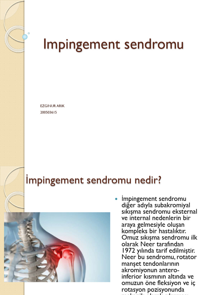 Impingement Sendromu | PDF