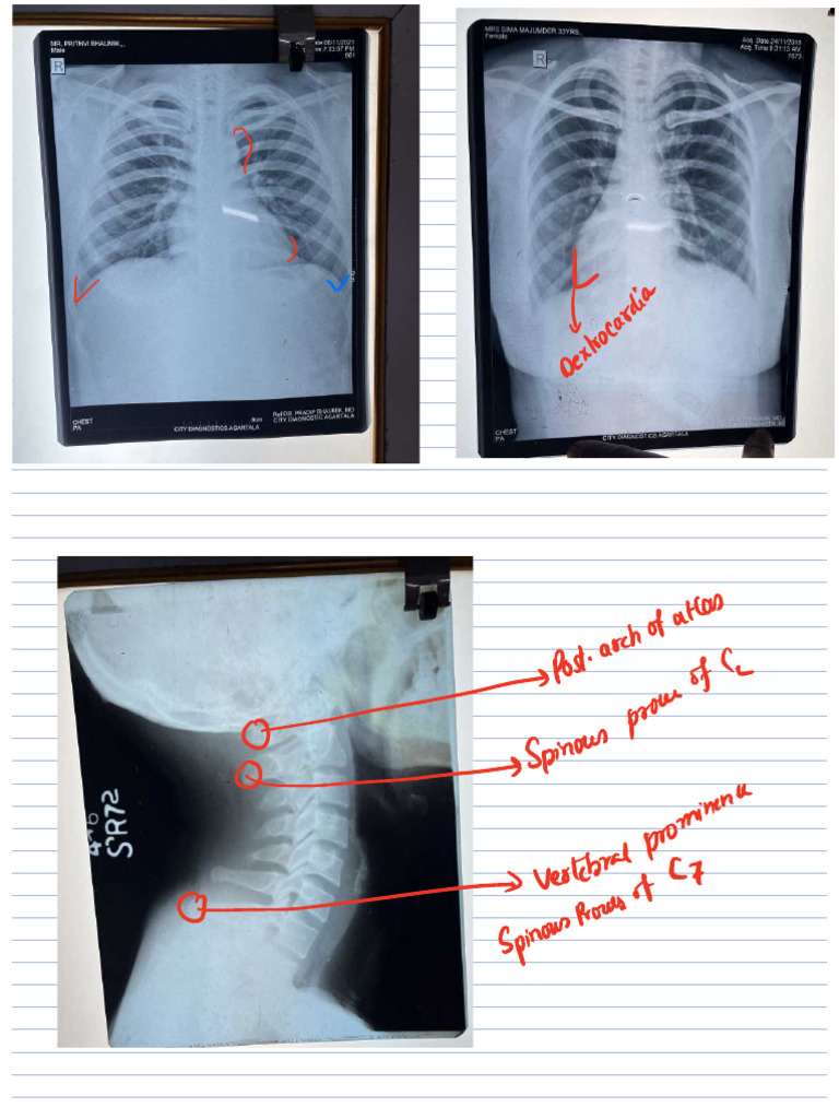Head and Neck Radiology | PDF