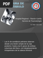 Fracturas de Cotilo: Clasificación y Tratamiento | PDF | Pelvis ...