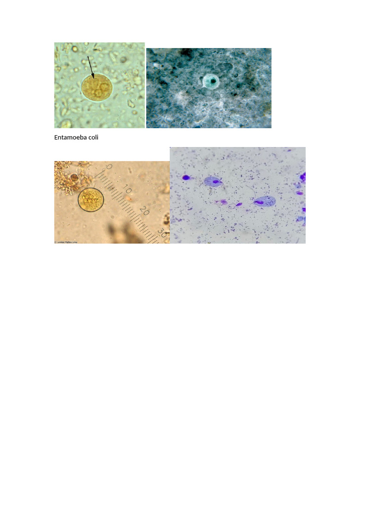Entamoeba Coli | PDF