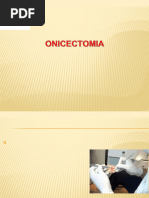 Onicectomía: Procedimiento y Cuidados | PDF | Clavo (anatomía) | Dedo ...