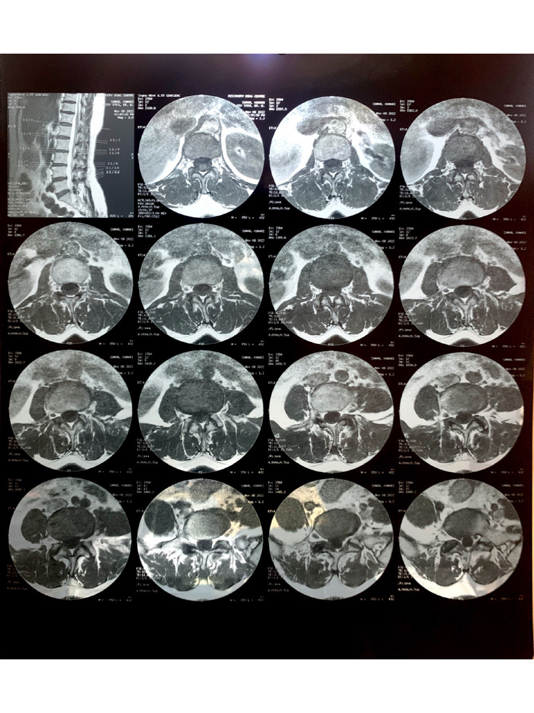 MRI Nov'2022 | PDF