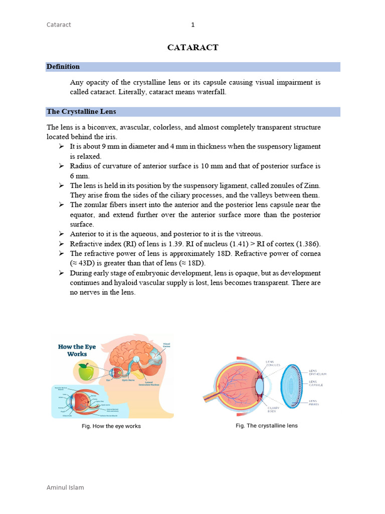 Cataract | PDF | Cataract | Epithelium