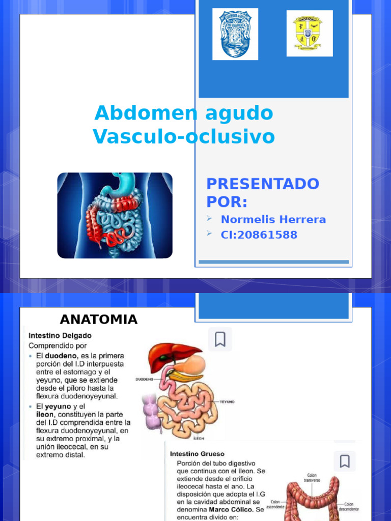 Abdomen Agudo Vasculo Oclusivo Rosma 1 | PDF