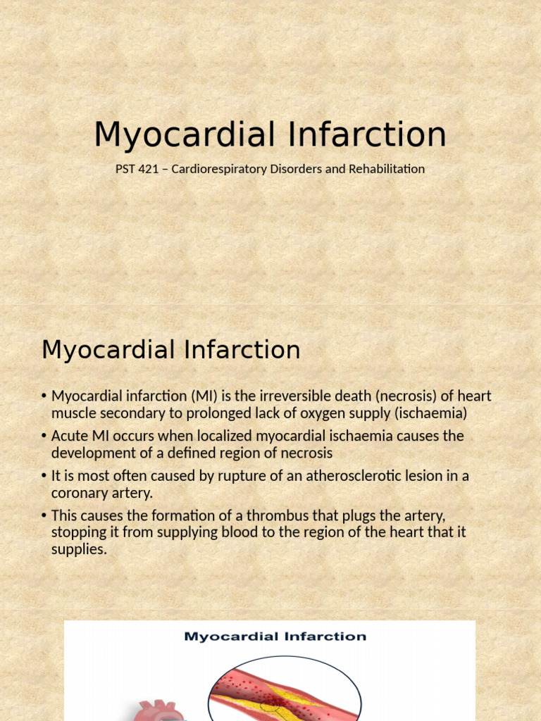 Understanding Myocardial Infarction Causes | PDF | Myocardial ...