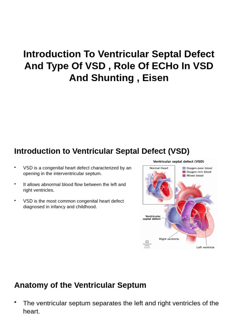 Introduction To Ventricular Septal Defect and Type of VSD, Role of ECHo ...