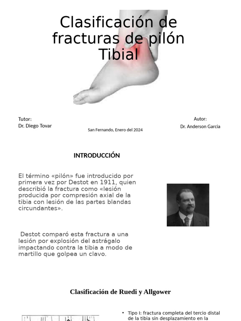 Clasificación de Fracturas de Pilón Tibial | PDF | Lesión | Sistema musculoesquelético