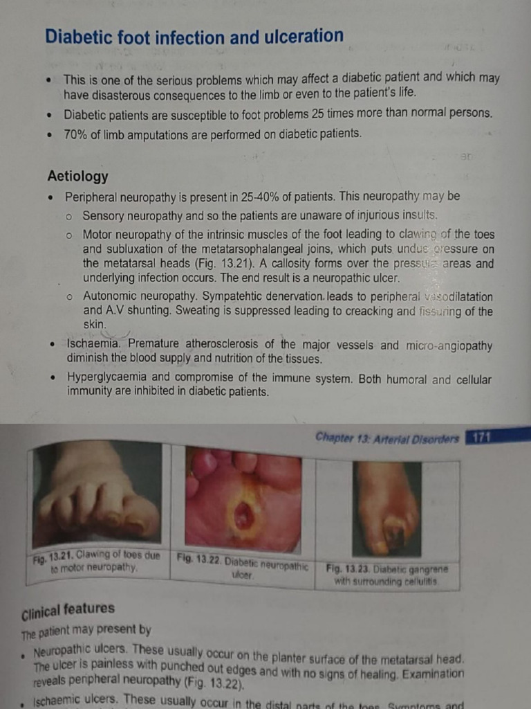 Diabetic Foot | PDF