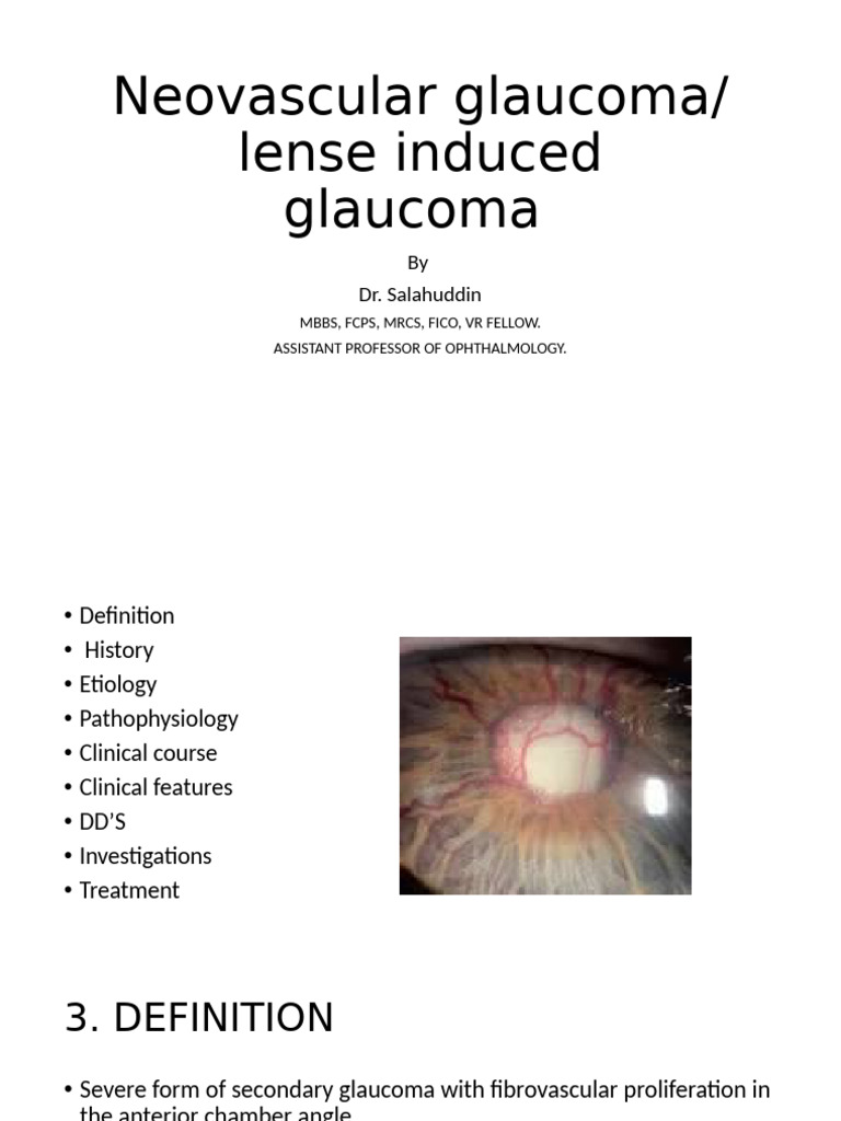 NVG, LIG | PDF | Glaucoma | Cataract