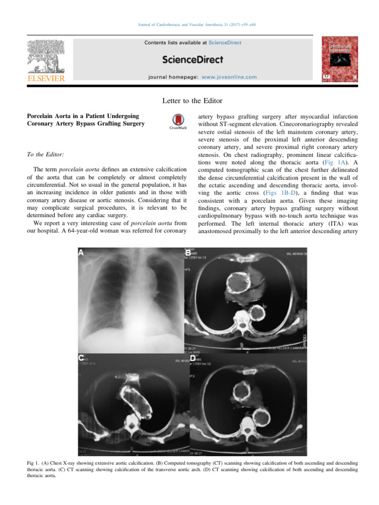 Porcelain Aorta in CABG Surgery Case Study | PDF | Cardiothoracic ...