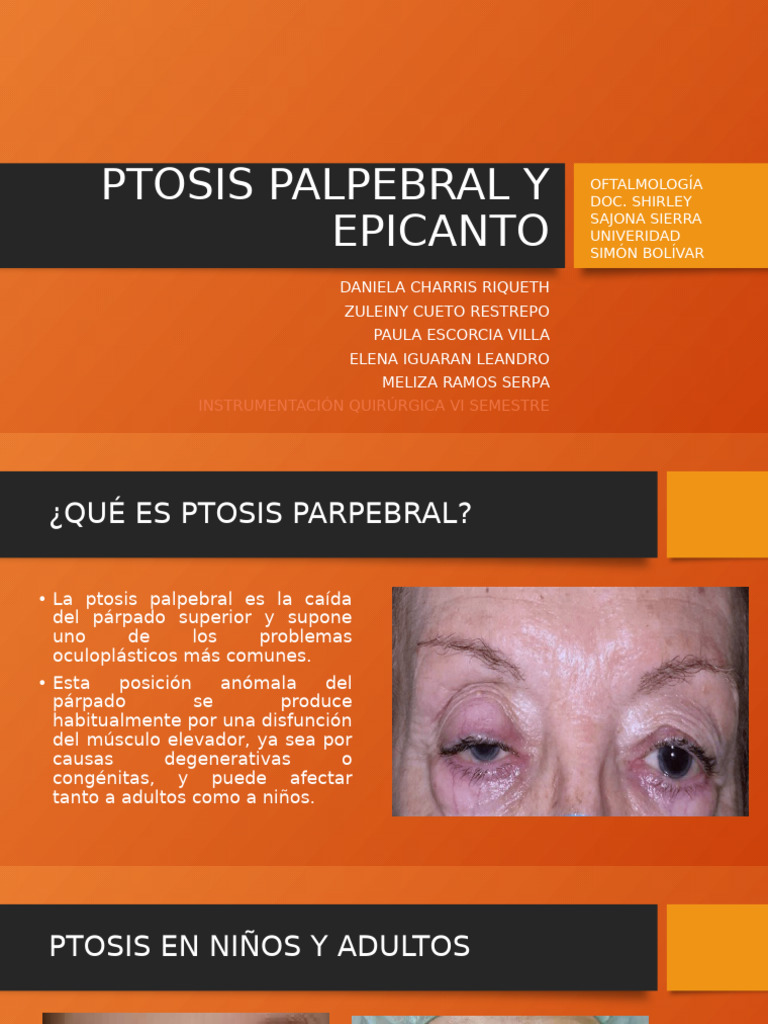 Ptosis Palpebral y Epicanto: Causas y Tratamiento | PDF ...
