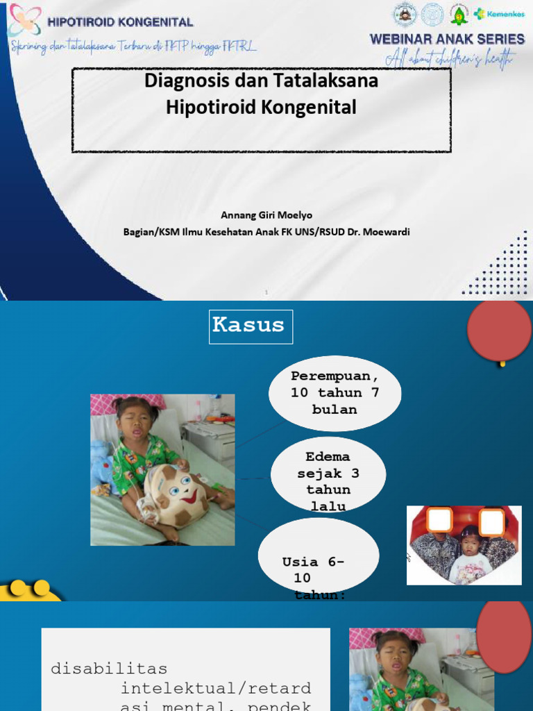 Tatalaksana Hipotiroid Kongenital | PDF